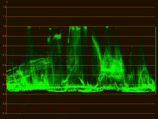 This is why your iris and waveform display don't work together in the ...